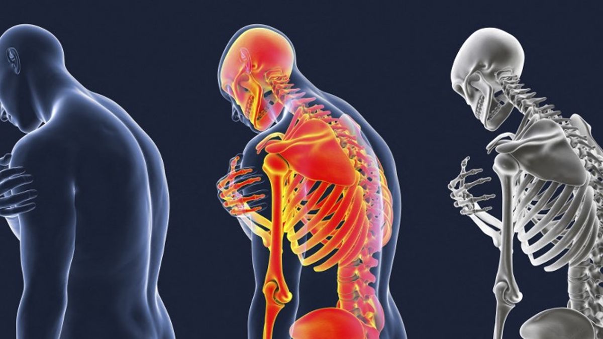 A nőket és a cukorbetegeket veszélyezteti a befagyott váll szindróma ...