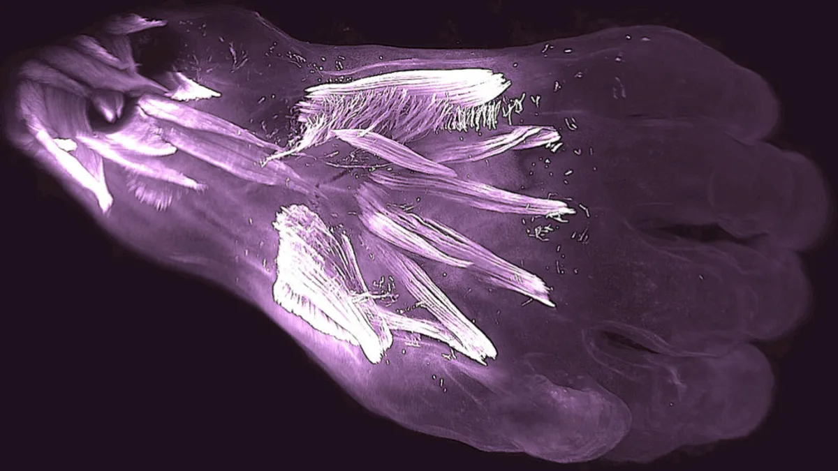 A farkcsontnál is haszontalanabb maradványt fedezték fel az emberben ...