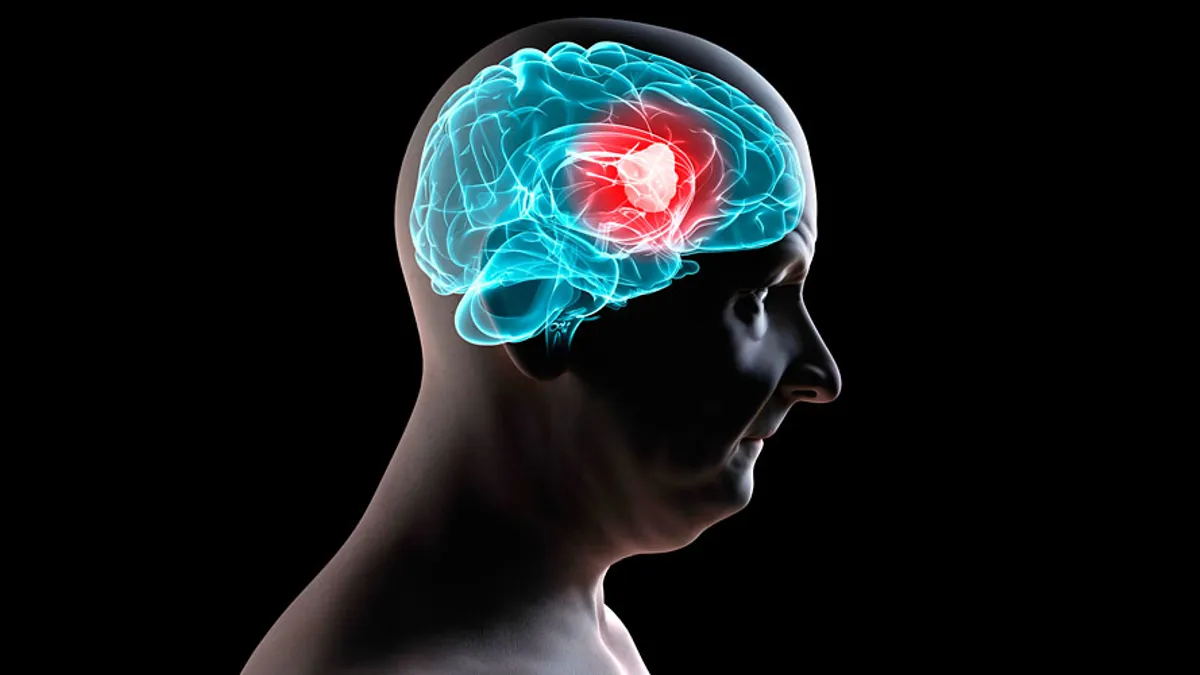 Immunvakcina agresszív agydaganat ellen - ORIGO